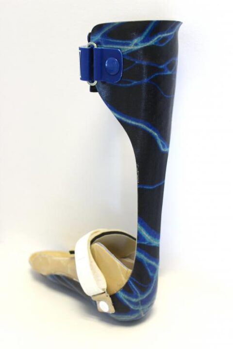 PIED / CHEVILLE - Fabrication prothèse & orthèse à vivre - Orthofiga