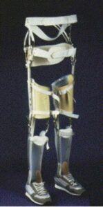 GRAND APPAREILLAGE DE MARCHE - Fabrication prothèse & orthèse à vivre ...